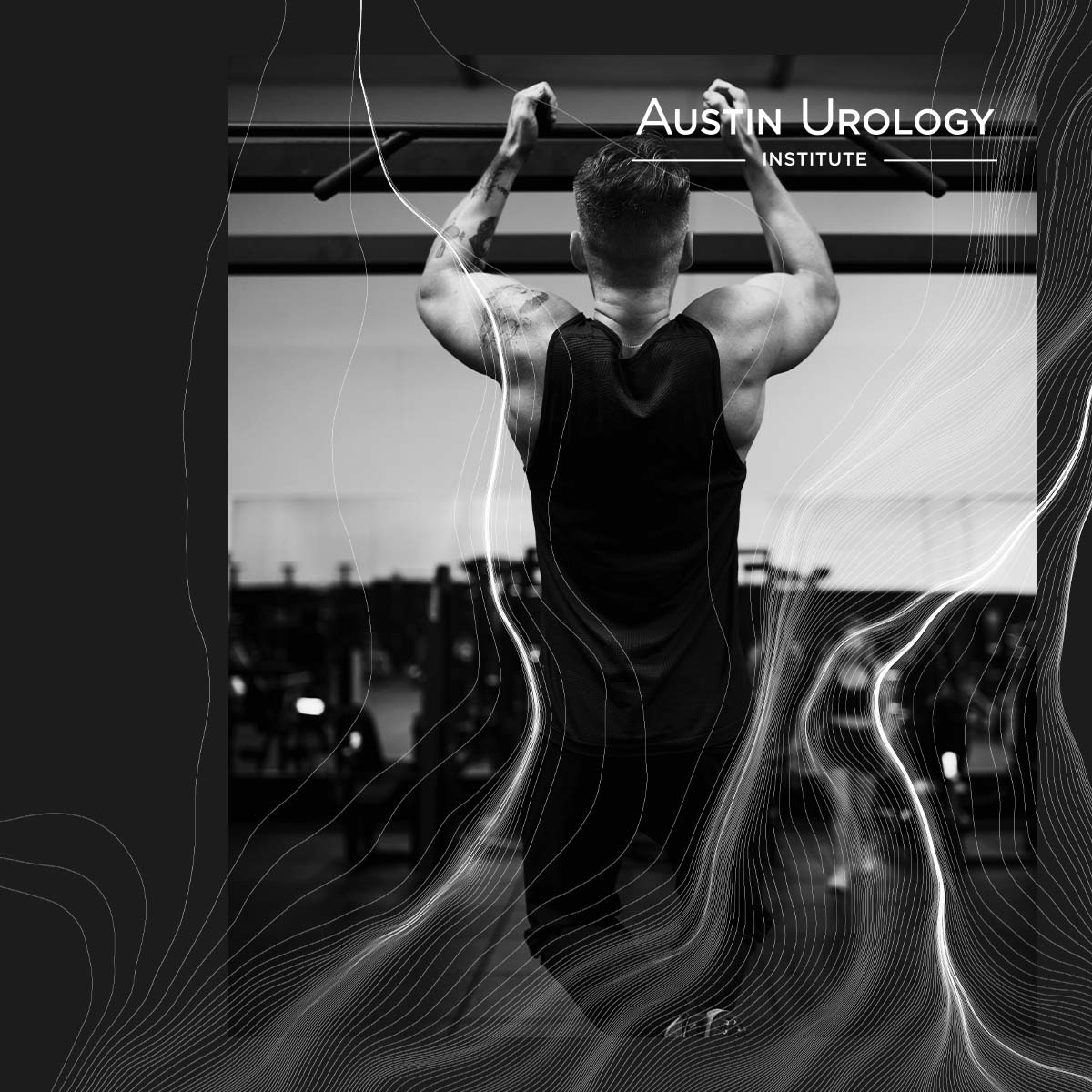 Can You Exercise with Kidney Stones? | Austin Urology Institute